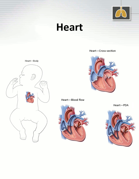 Heart - NICU Parent Education Resources